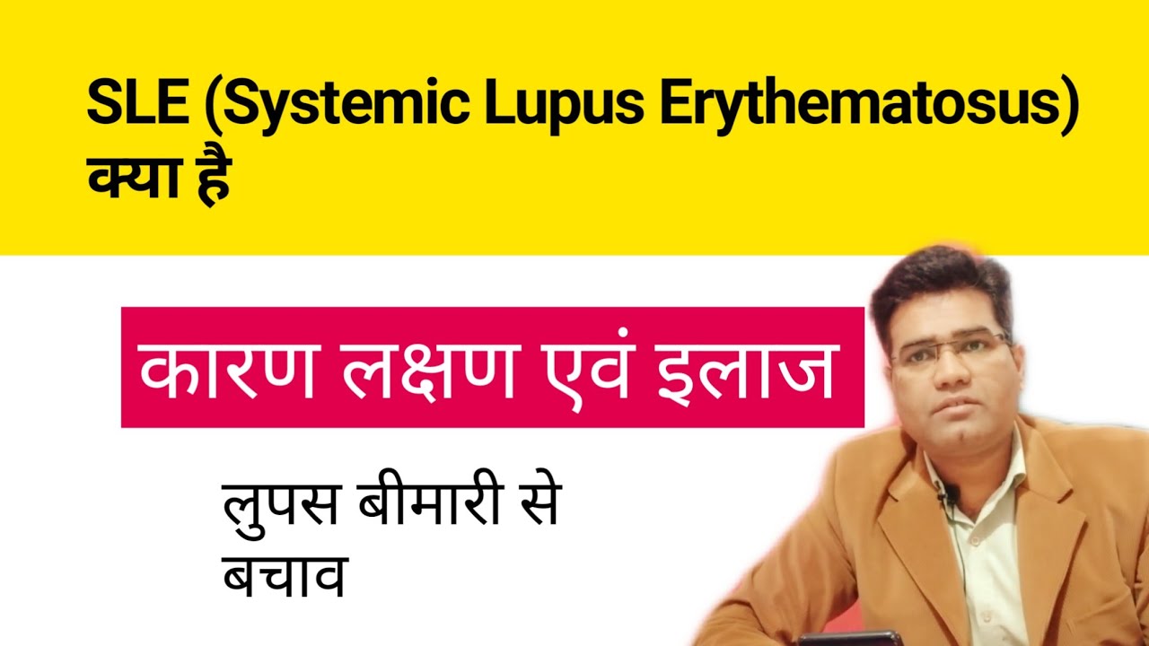 What is SLE? Cause, Symptoms and Treatment | How to Prevent Systemic ...