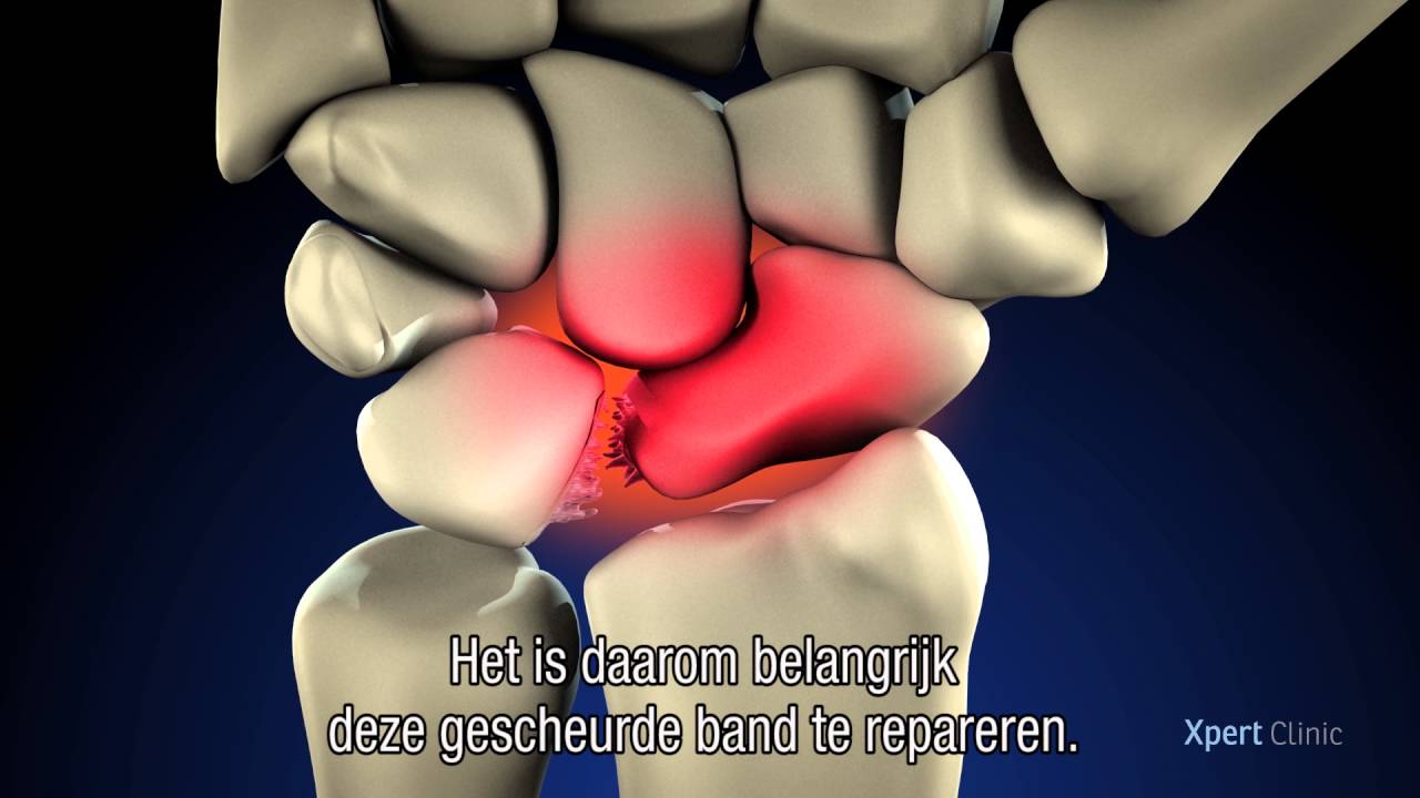 Brunelli Plastiek - YouTube