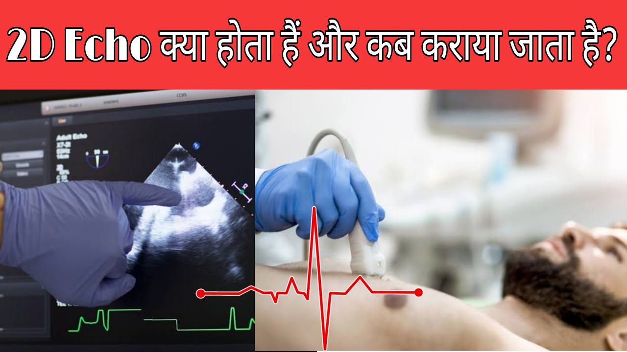 2D Echo क्यों कराते हैं और कैसे होता हैं? || Echocardiogram Test || Dr ...