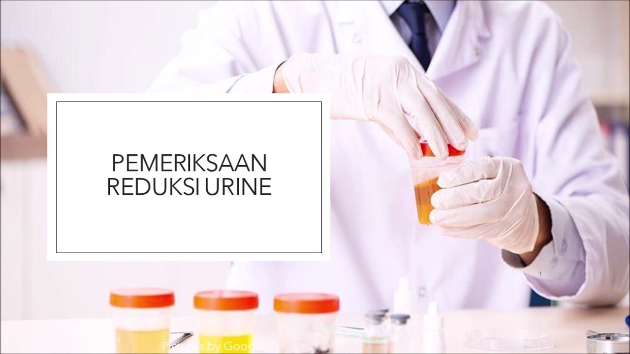 PEMERIKSAAN REDUKSI URINE - YouTube