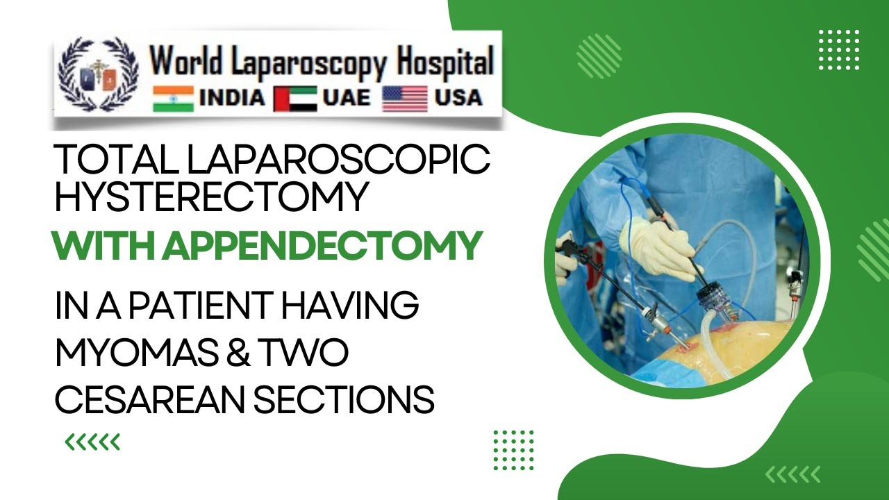 Total Laparoscopic Hysterectomy with Appendectomy in a Patient having ...