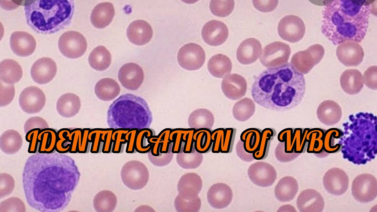 Identification Of WBC||How To Identify white Blood Cells||Heamatology # ...