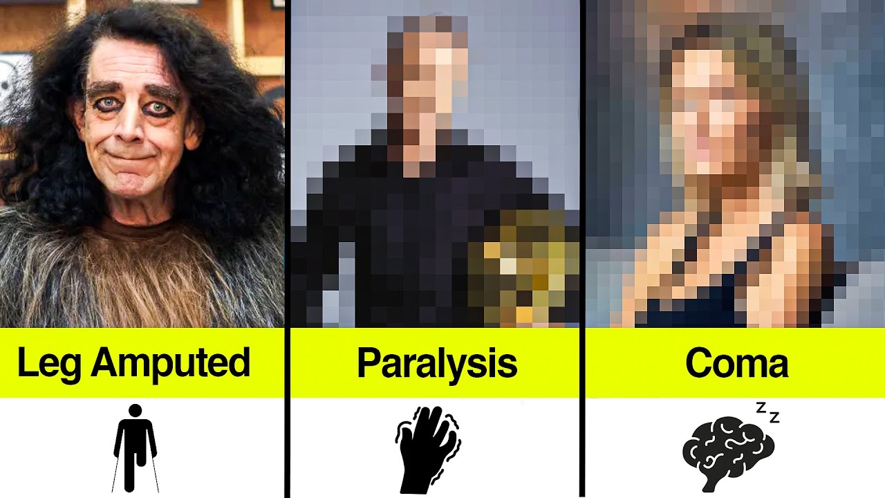 Star Wars Actors Who Got LIFELONG Disabilities From Filming - YouTube