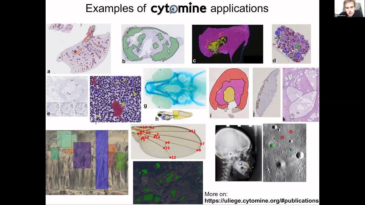 Introduction to Cytomine: Collaborative Web Annotation -- [NEUBIAS ...