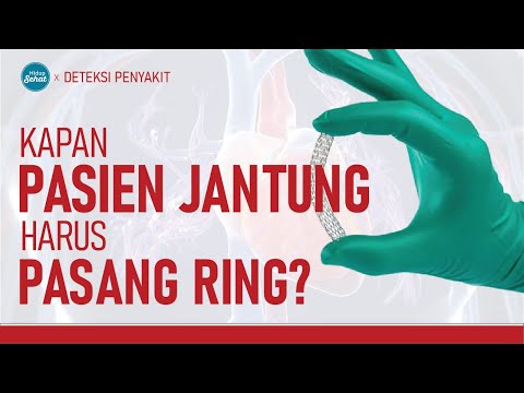 Tanda Pasien Sakit Jantung Harus Pasang Ring | Hidup Sehat tvOne