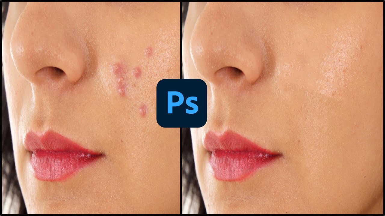 Photoshop Tutorials 2023 | How to remove pimples from face in Photoshop ...