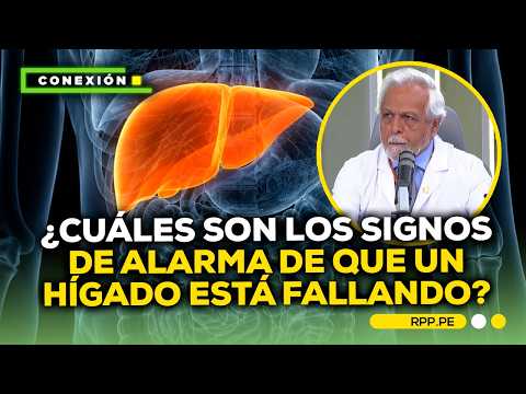 Especialista explica las señales de alerta de una posible falla hepática #CONEXIONRPP