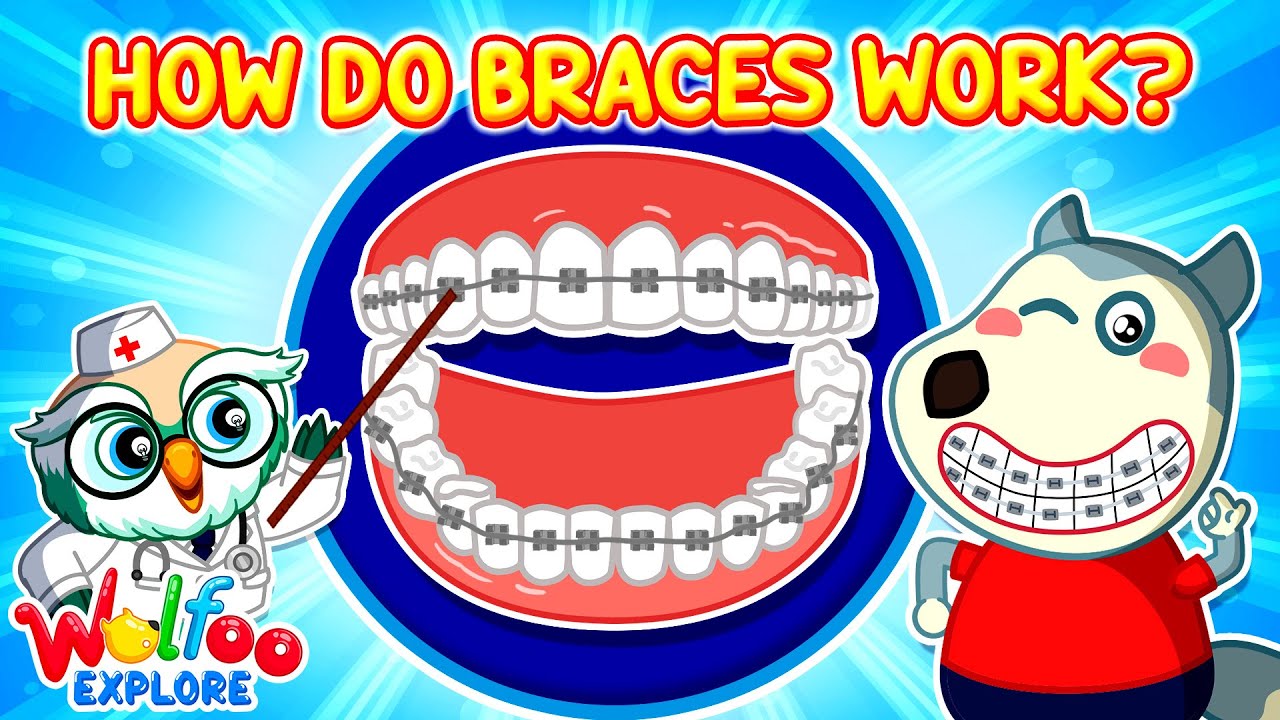 Why Do People Wear Braces? 😬🦷 | 🔍 Wolfoo Explore - Human Body ...