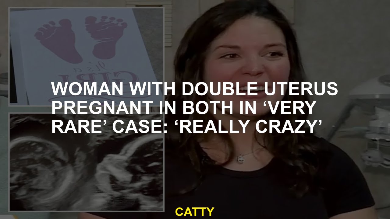 In both of them, in case of ‘very rare’, the double uterus is pregnant ...