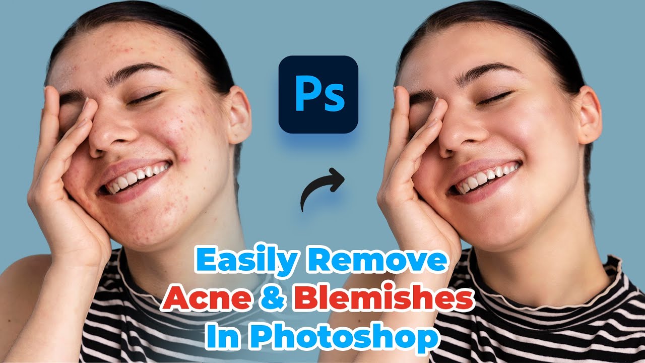 Easily Remove Acne & Blemishes In Photoshop | SKIN RETOUCHING - YouTube