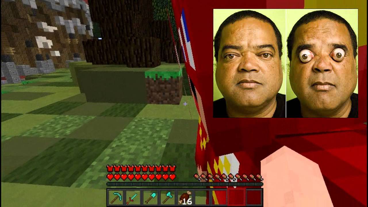 Retarded Skin - YouTube