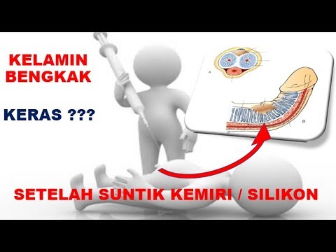 Obat penis Bengkak dan Keras Karena Suntik Minyak Urang Aring atau Suntik Minyak Kemiri - YouTube