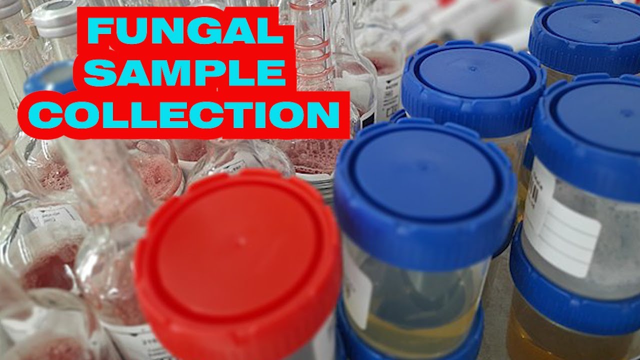 FUNGAL SAMPLE COLLECTION - YouTube