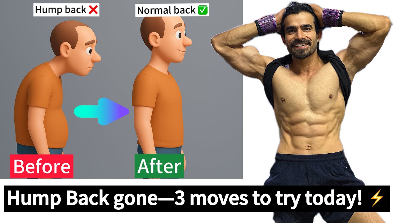 Best 3 home drills to reduce humpback—must try! 🔥#humpback # ...