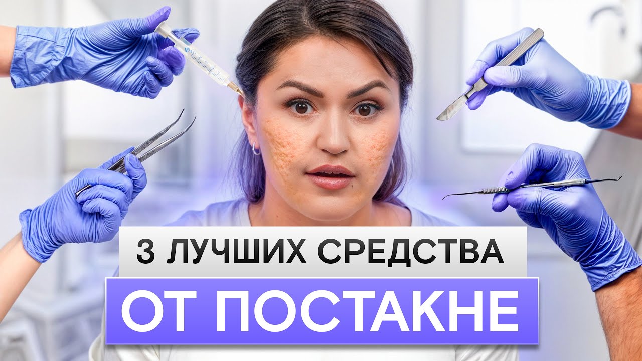 СЛЕДЫ ПОСЛЕ АКНЕ МГНОВЕННО УЙДУТ Как убрать шрамы и рубцы на лице