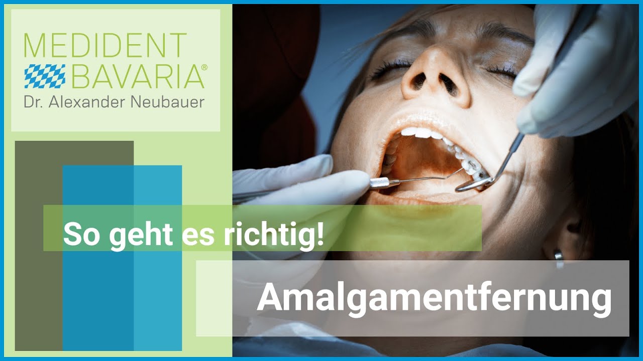 Die sichere und saubere Amalgamentfernung - so geht es richtig! - YouTube