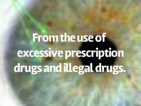 Iridology marking known as psora or drug spots - YouTube