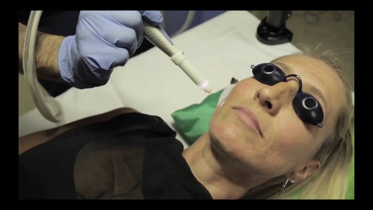 Plasma Derma - YouTube