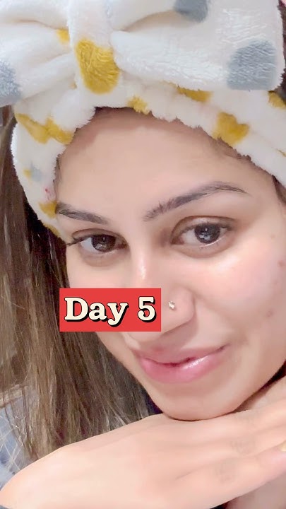 ️ Day 5 of 7 days clear skin challenge ️ Stay continued #youtubeshorts #viralvideo #shorts #diy ...