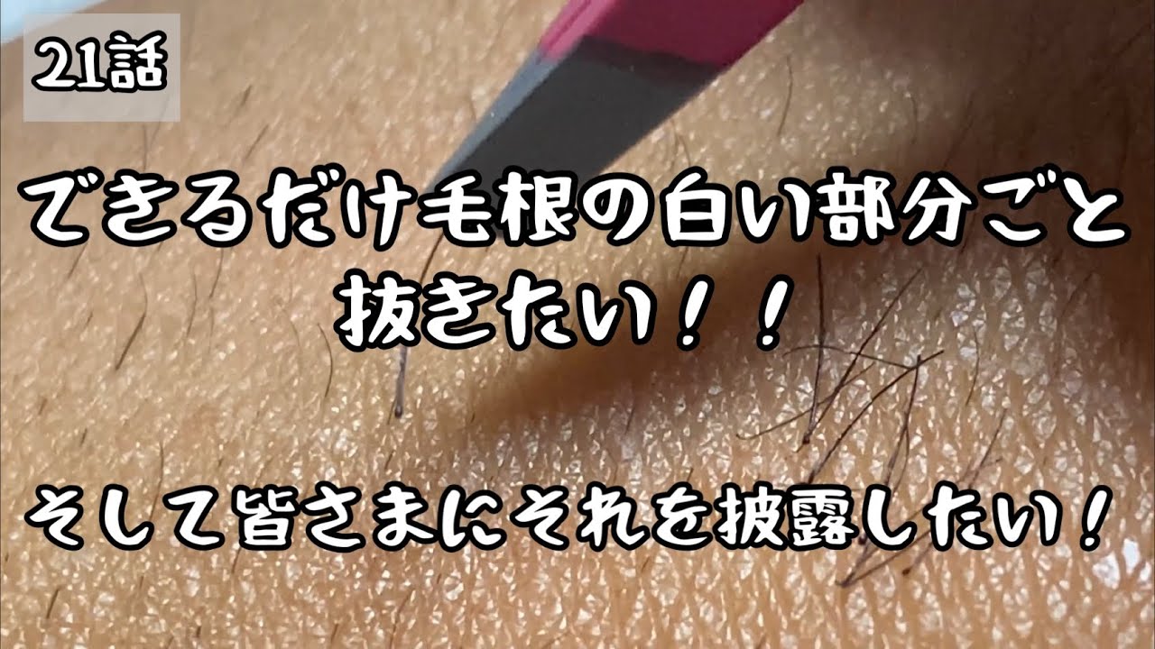 【毛抜き】毛根の白い部分を綺麗に抜いて見せたい!動画!! Youtube