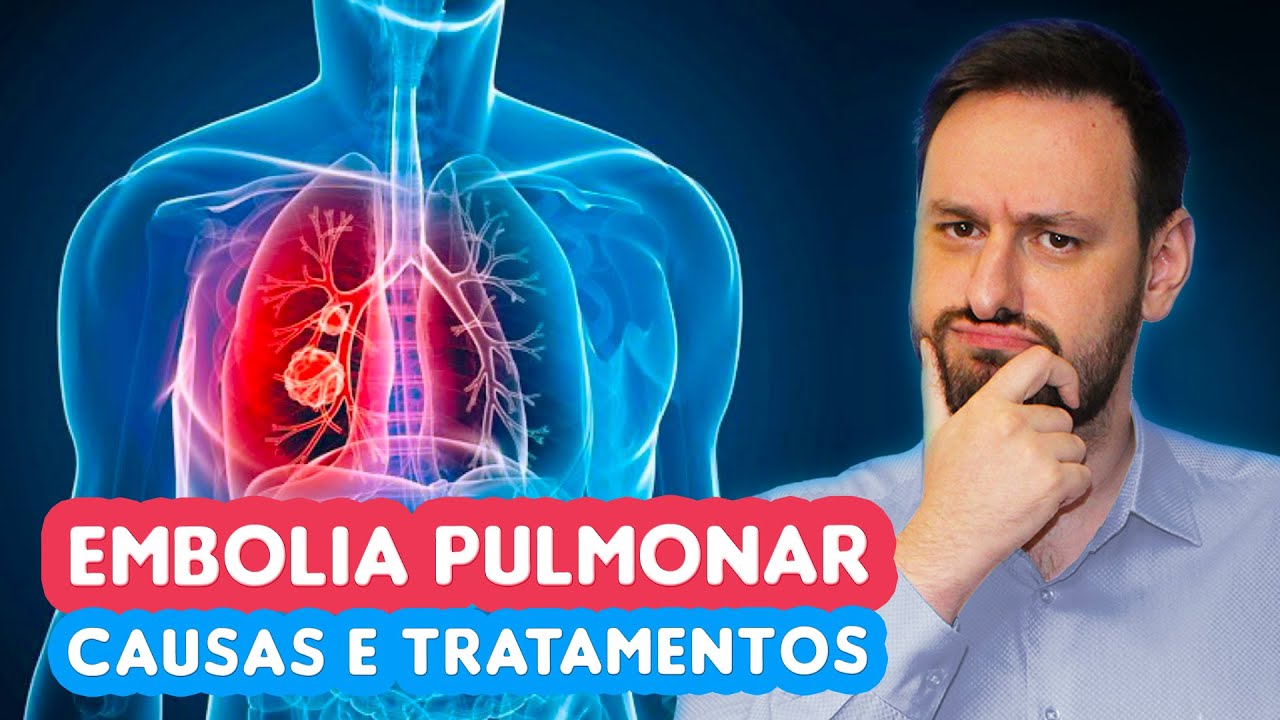 Causas De La Embolia Pulmonar