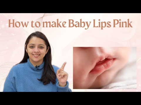बच्चों के होठों को हमेशा गुलाबी कैसे रखें | How to make baby lips pink