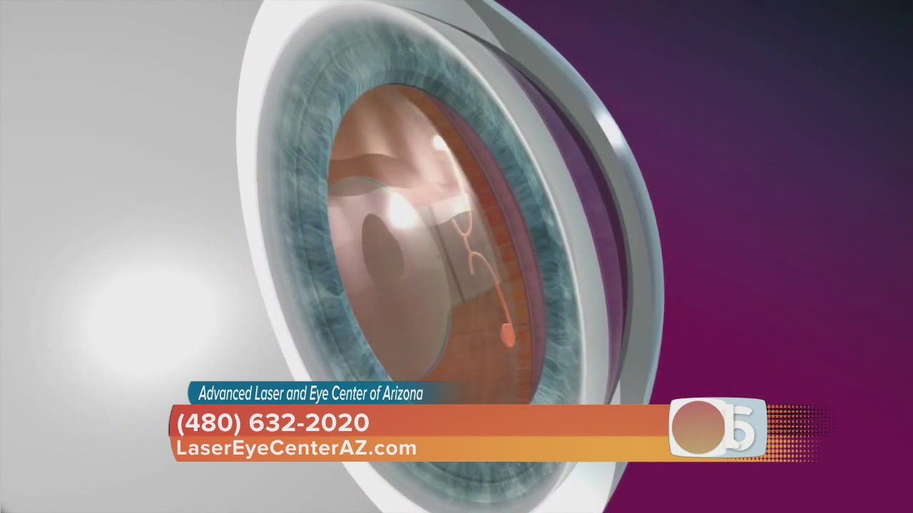 Advanced Laser and Eye Center of Arizona offers dropless cataract ...