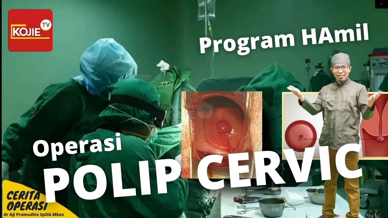 Cerita Operasi | Polip Leher Rahim (Cervic) pd Pasien Promill Seperti ...