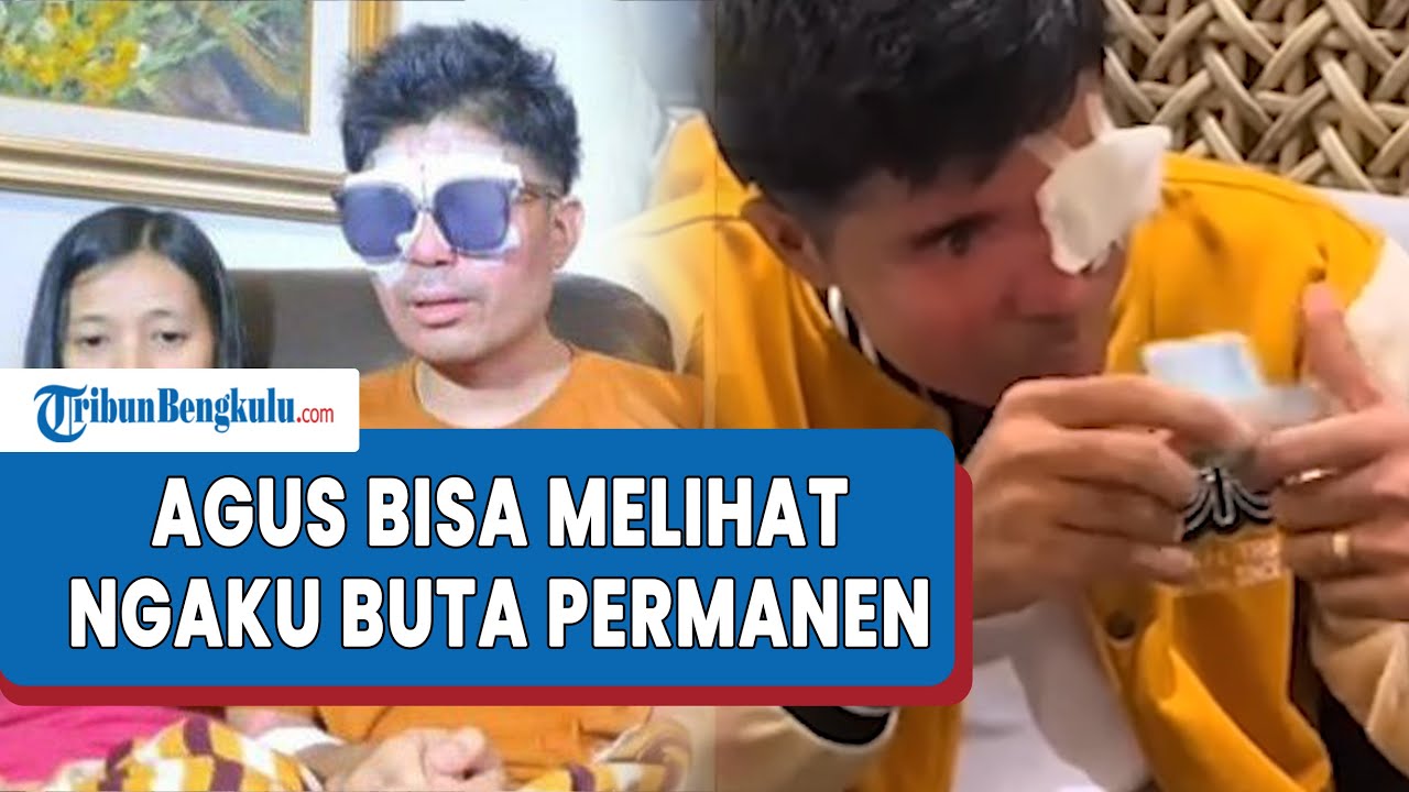 Agus Bisa Melihat Uang Rp 50 Ribu, Sempat Ngotot Matanya Buta Permanen ...