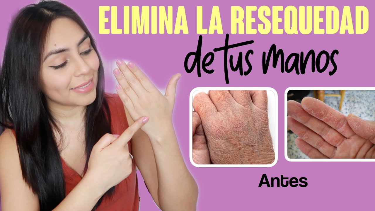 Remedio fácil para la resequedad de tus manos | LAS DEJÁ SUPER SUAVES ...