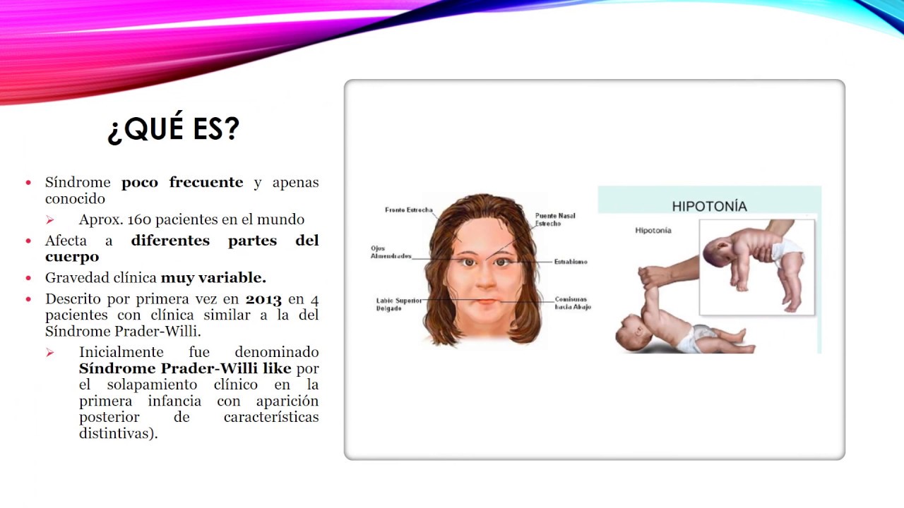 AESYS: Breve explicación de qué es el Síndrome de Schaaf-Yang - YouTube