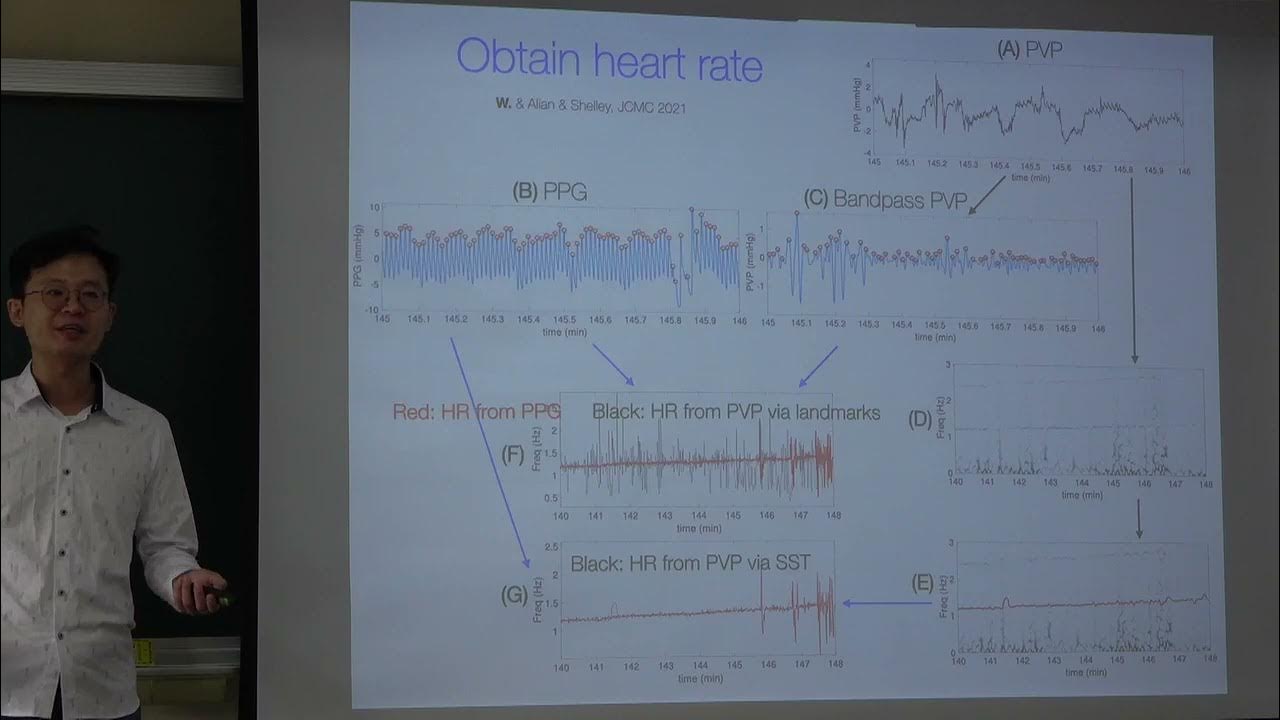 Some applications of the synchrosqueezing transform (SST) - YouTube
