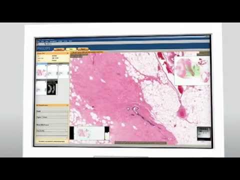 Pathology Solutions - Philips Digital Pathology - YouTube