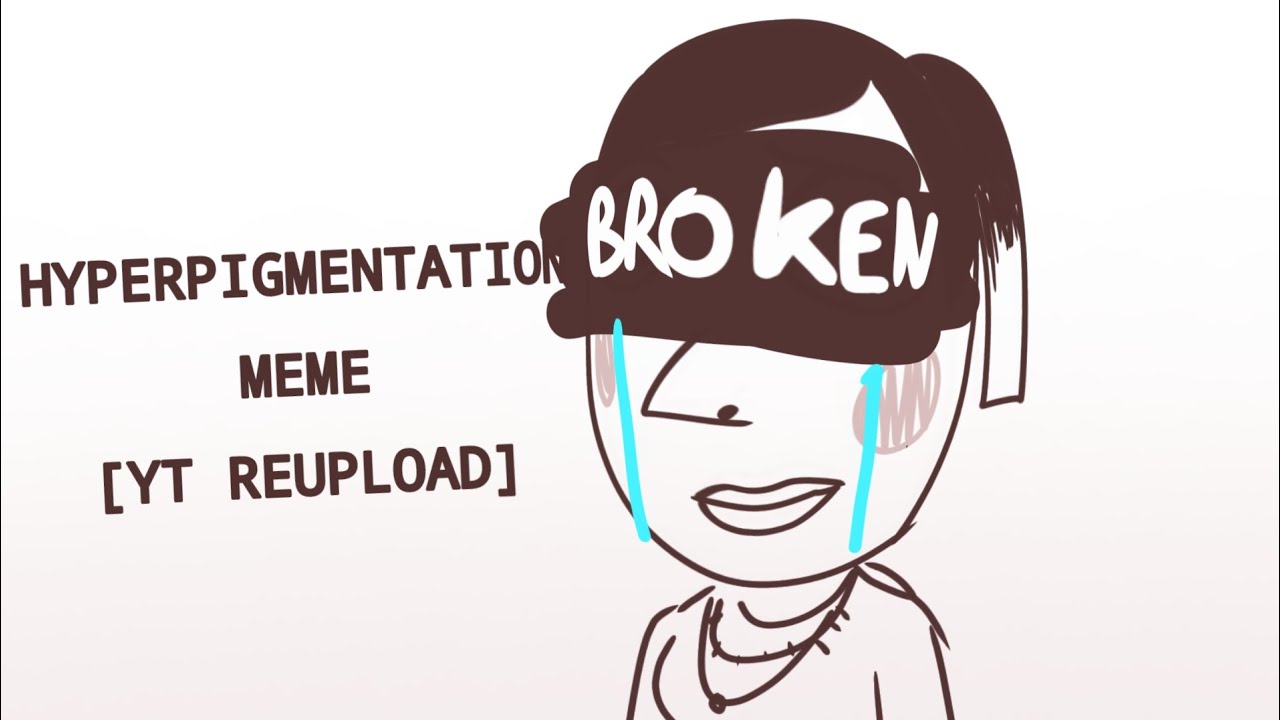 Hyperpigmentation Meme | YT Reupload - YouTube