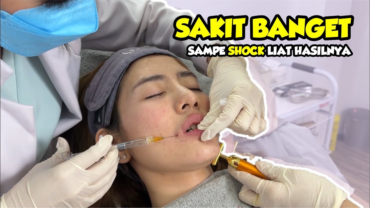 FILLER BIBIR BIKIN JONTOR? SAKIT BANGET LOH - YouTube