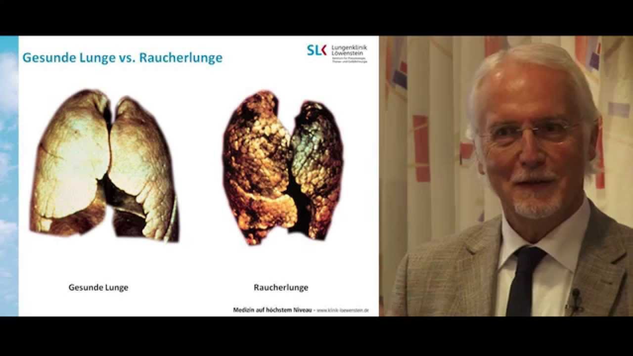 Bronchialkarzinom/Lungenkrebs: Die Fortschritte in der Therapie | Dr ...