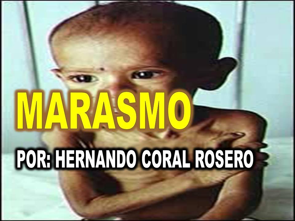 MARASMO - YouTube