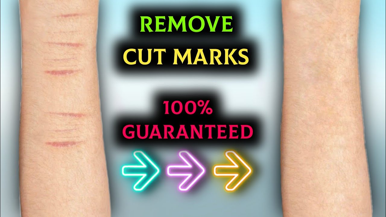 How To Remove Cut Marks Permanently 100 Guaranteed YouTube how-to-remove-cut-marks-permanently-100-guaranteed-youtube