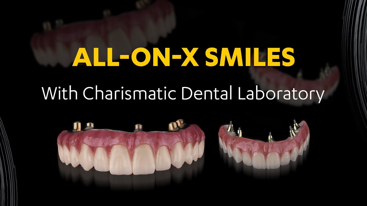 All-on-X and The 2 Step Technic by Charismatic Dental Laboratory - YouTube