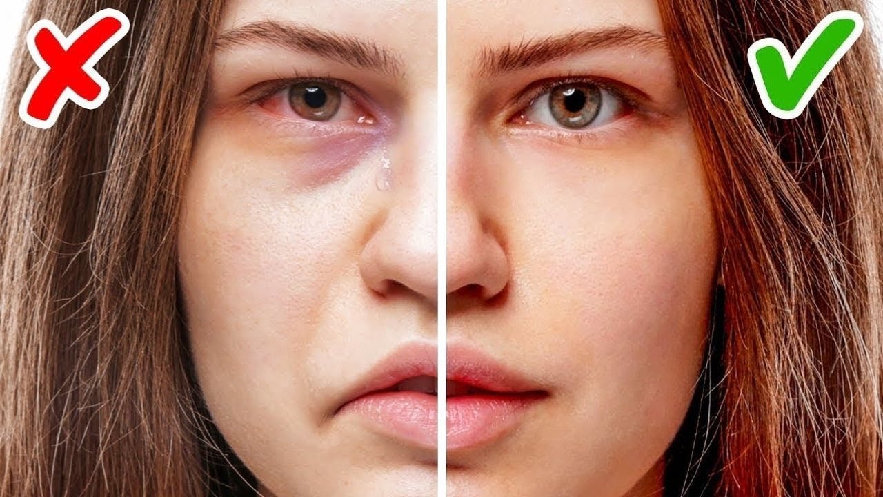 Popraw wygląd skóry twarzy NIE jedząc tych produktów - Jedzenie które ...