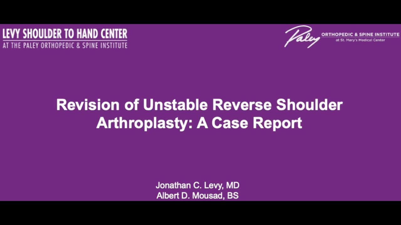 Revision Reverse Shoulder Replacement for Recurrent Dislocations - YouTube