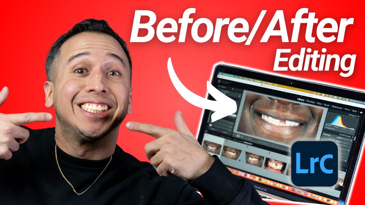 How to Edit Dental Photos Part II: Matching Skin Tones like a Boss ...