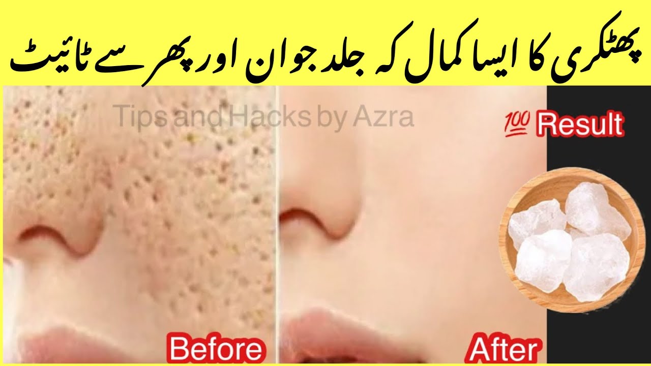 fitkari face pack for wrinkles | alum stone for face I alum benefits in ...