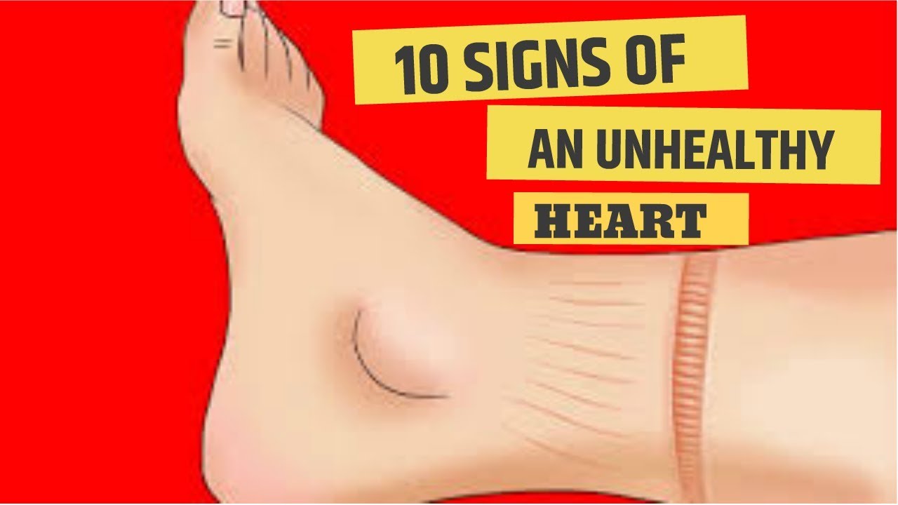 Here are 10 signs of an unhealthy heart - YouTube