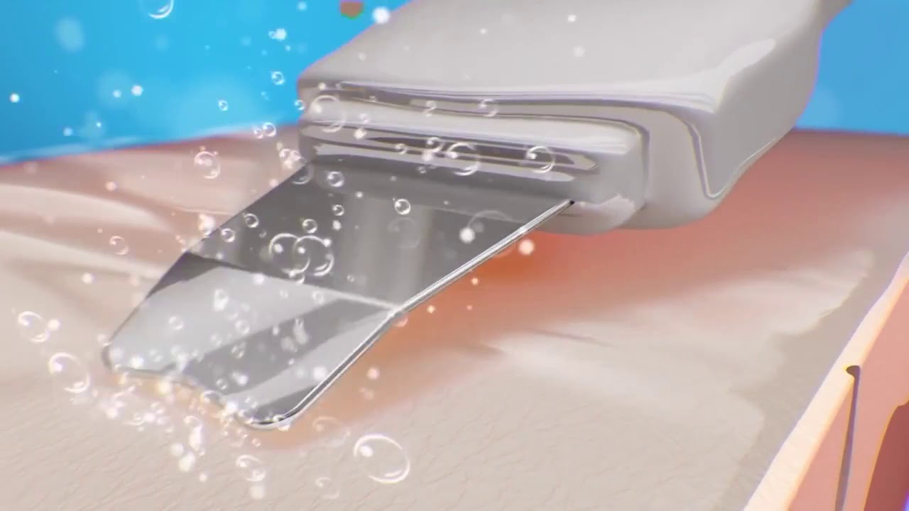 Ultrasonic Skin Spatula // Extracting Skin Scrubber - YouTube