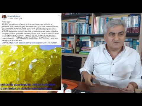Çıbana Ne İyi Gelir?, Çıban Nasıl Geçer?, Çıban Nasıl Kurutulur?, Çıban Nasıl Kurutulur?