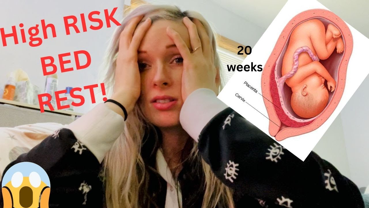 20 WEEKS Pregnant complete placenta previa posterior - YouTube