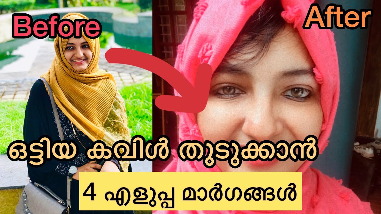 4 Easy Tips .to gain fat cheeks Easy Remedy for get chubby Face|How to ...