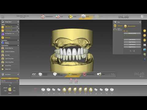 inLab SW 20 Tutorial 3b (EN) - Digital Dentures – Design – IPN 3D ...