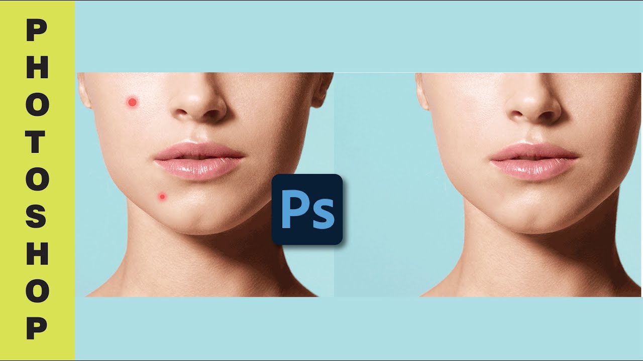 How to remove pimples from face in Adobe Photoshop - YouTube